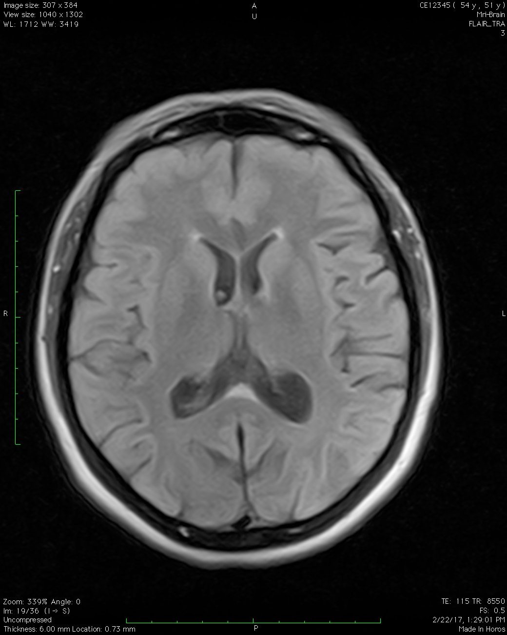 MRI i-Open 0.5 Tesla - IH Medical Equipment LLC