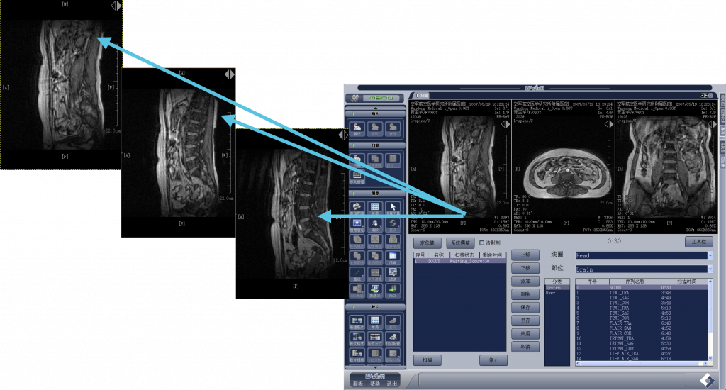 MRI i-Open 0.5 Tesla - IH Medical Equipment LLC