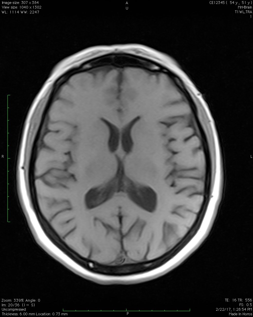 MRI i-Open 0.5 Tesla - IH Medical Equipment LLC